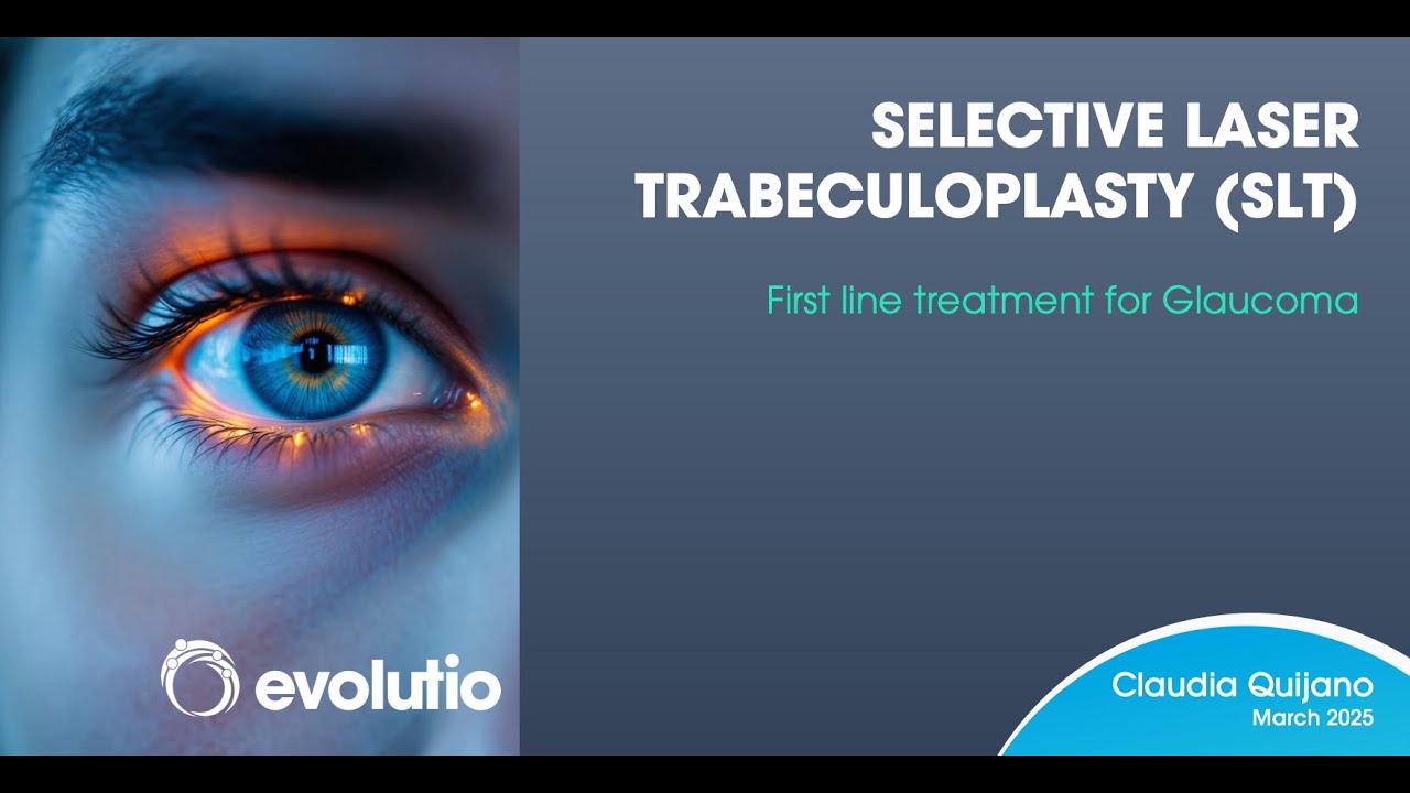 Selective Laser Trabeculoplasty (SLT) | A Modern Solution for Glaucoma ...