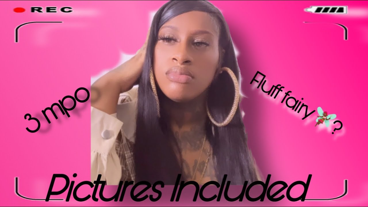 3MPO | PICS INCLUDED | FLUFF 🧚🏾‍♀️ FAIRY | MENTAL HEALTH & SURGERY ...