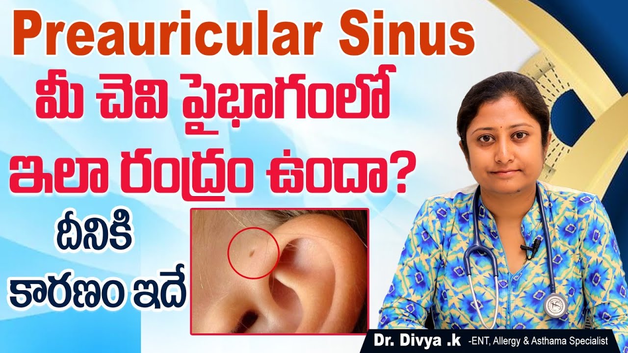 చెవి పైభాగం లో ఇలా రంద్రం ఉందా? || What Causes Preauricular Sinus ...
