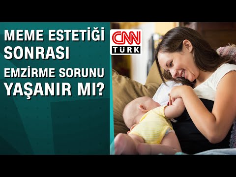 Meme estetiği sonrası emzirme sorunu yaşanır mı?