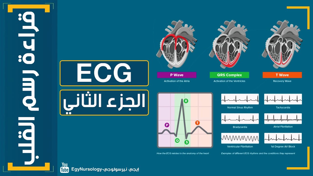 شرح قراءة رسم القلب | (ECG) الجزء الثاني - EgyNursology - YouTube