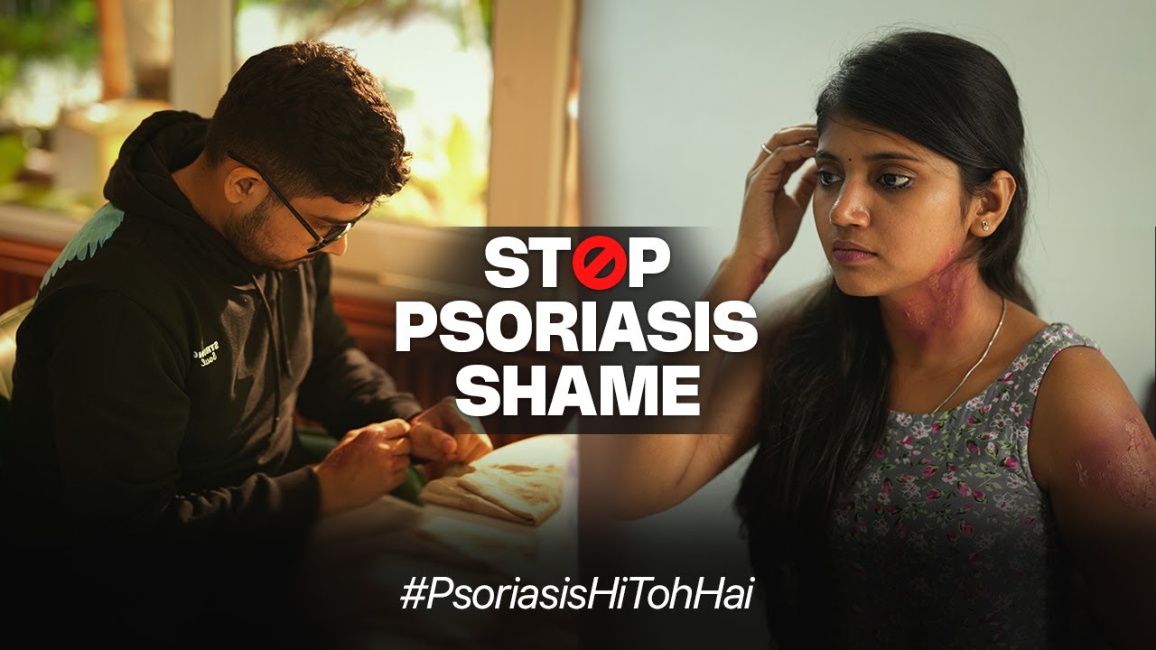 Let's Break Stigma for Psoriasis Patients | Psoriasis Awareness Month ...