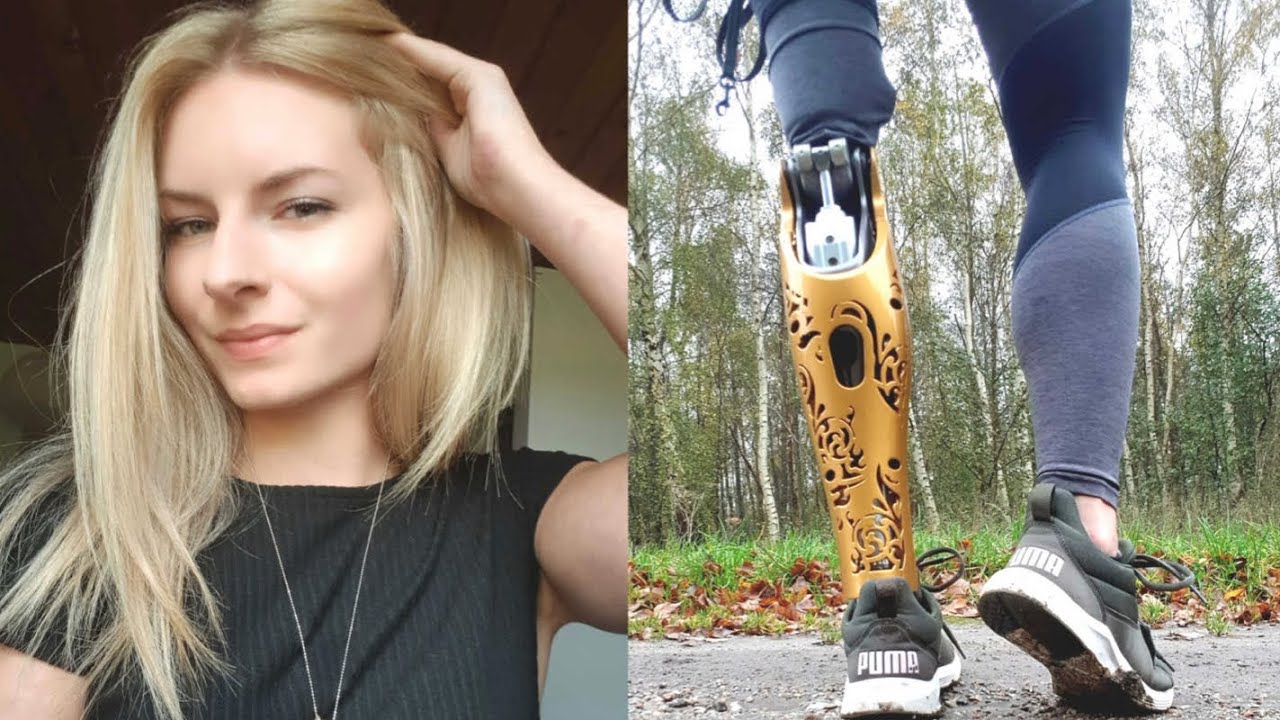 SMART FOOT IN MOTION, Adjustable Prosthetic Feet,High heels prosthetic ...