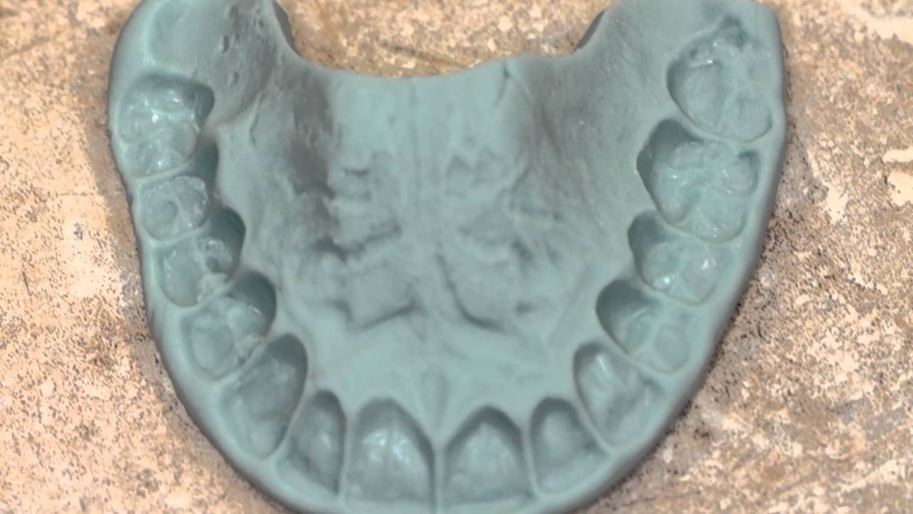 Tips and Tricks: Reduction Guides - YouTube