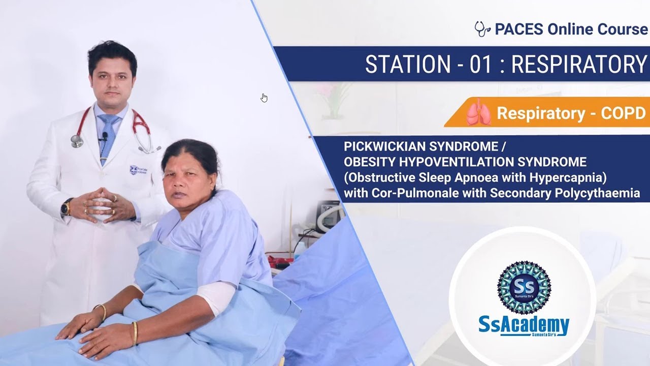 PACES 2023 New Format | Pickwickian Syndrome | Obstructive sleep Apnoea ...