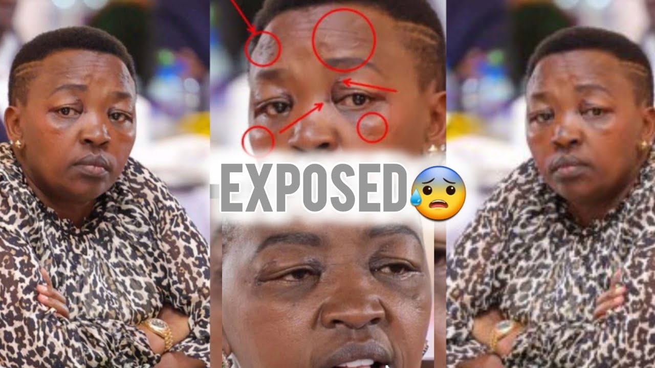 TRUTH EXPOSED! WHY RACHEL RUTO'S FACE is SWOLLEN - YouTube