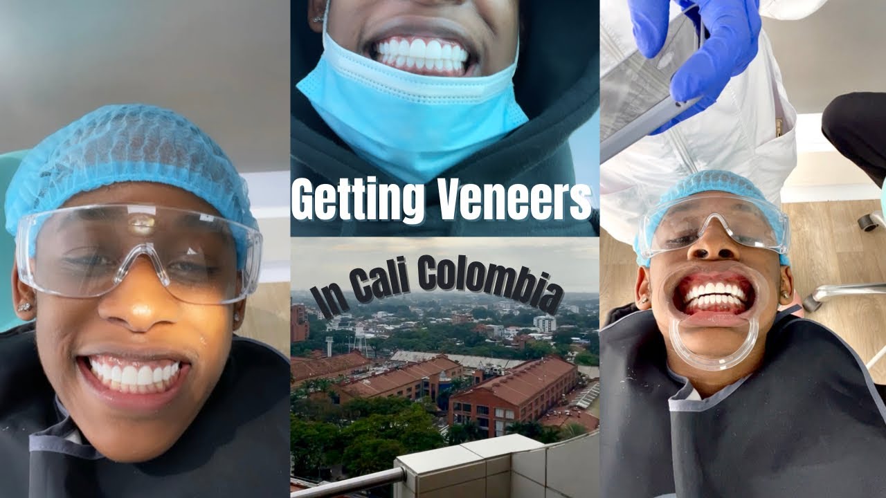 Getting composite veneers in Cali Colombia | Dentoclub | travel vlog ...