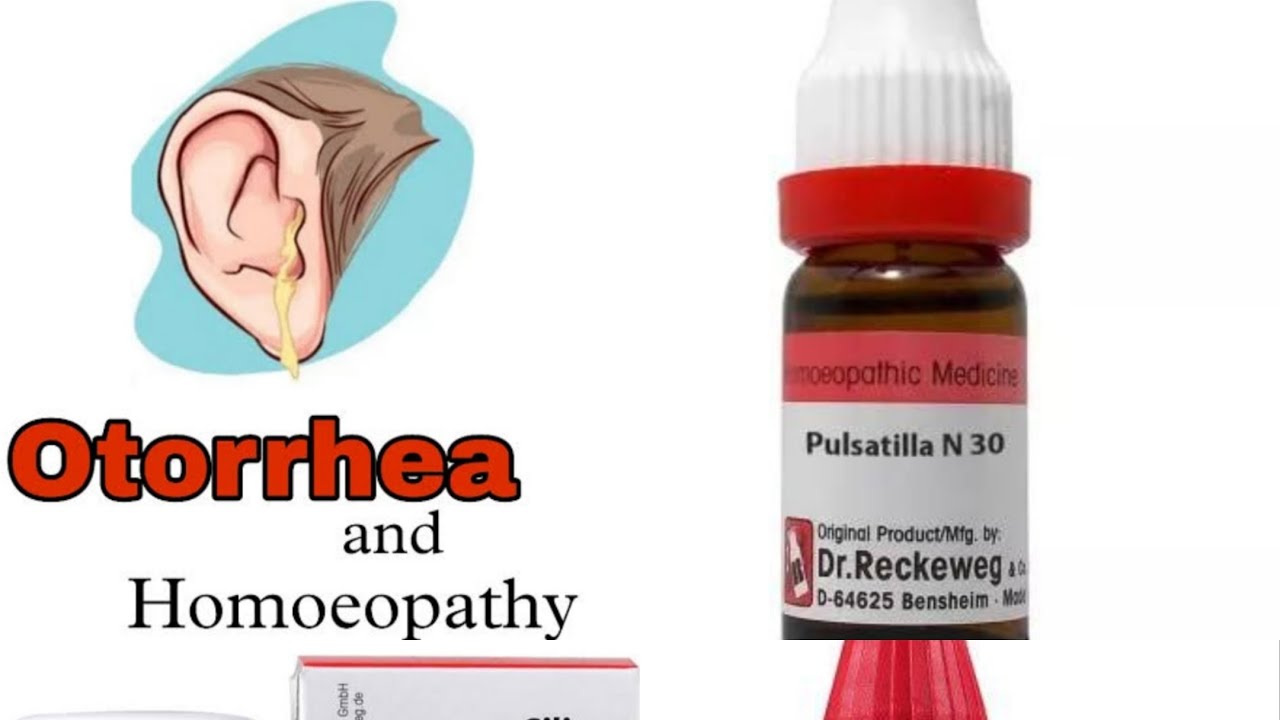 Otorrhea कान बहना को कैसे ठिक करे कौनसी दवा ले ? Effective homoeopathic ...