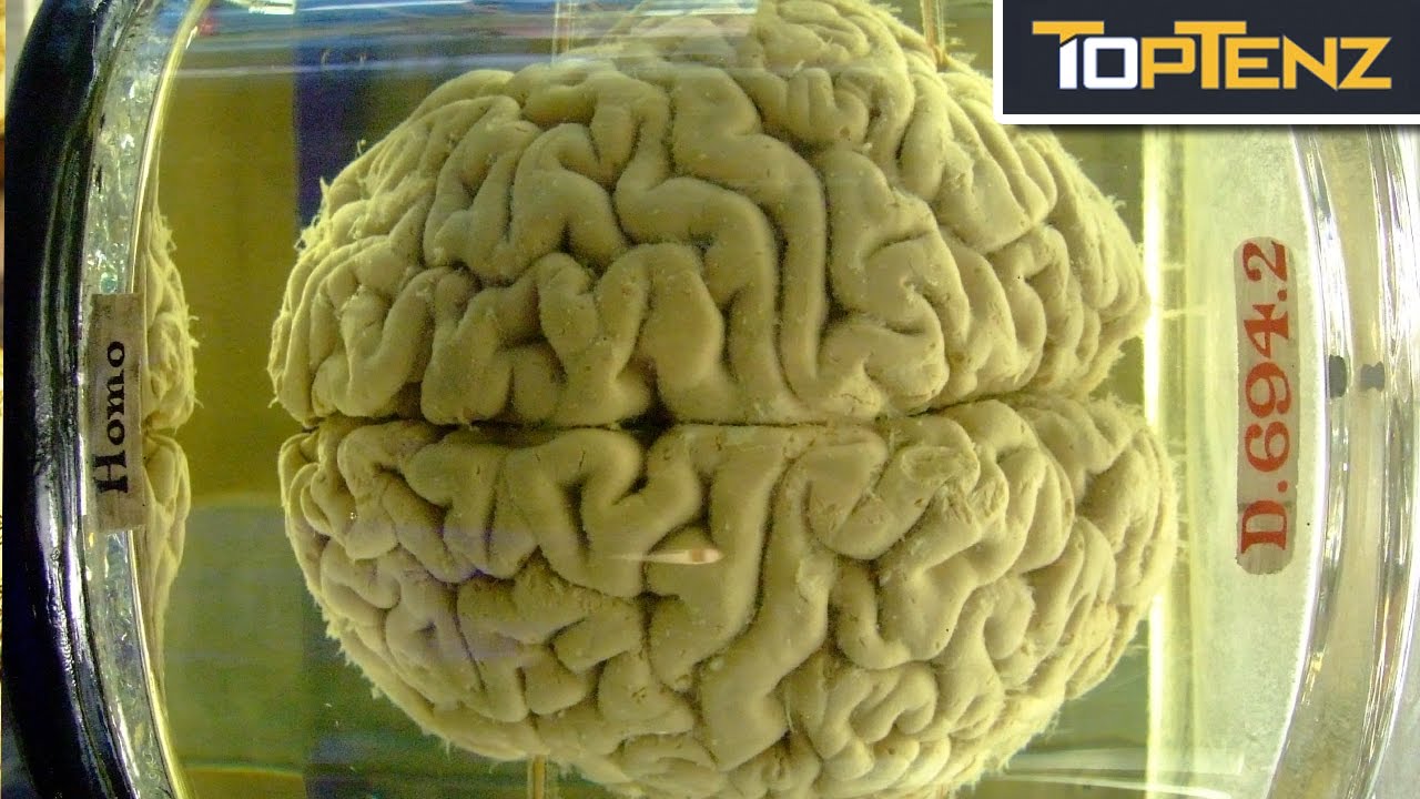 Top 10 Most FAMOUS Preserved BODY PARTS - YouTube