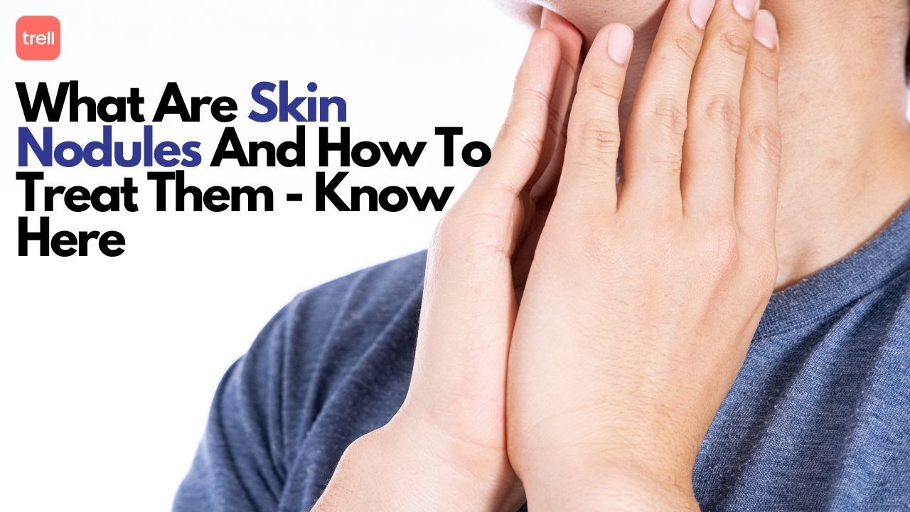 What Are Skin Nodules And How To Treat Them - Know Here #skinnodules # ...