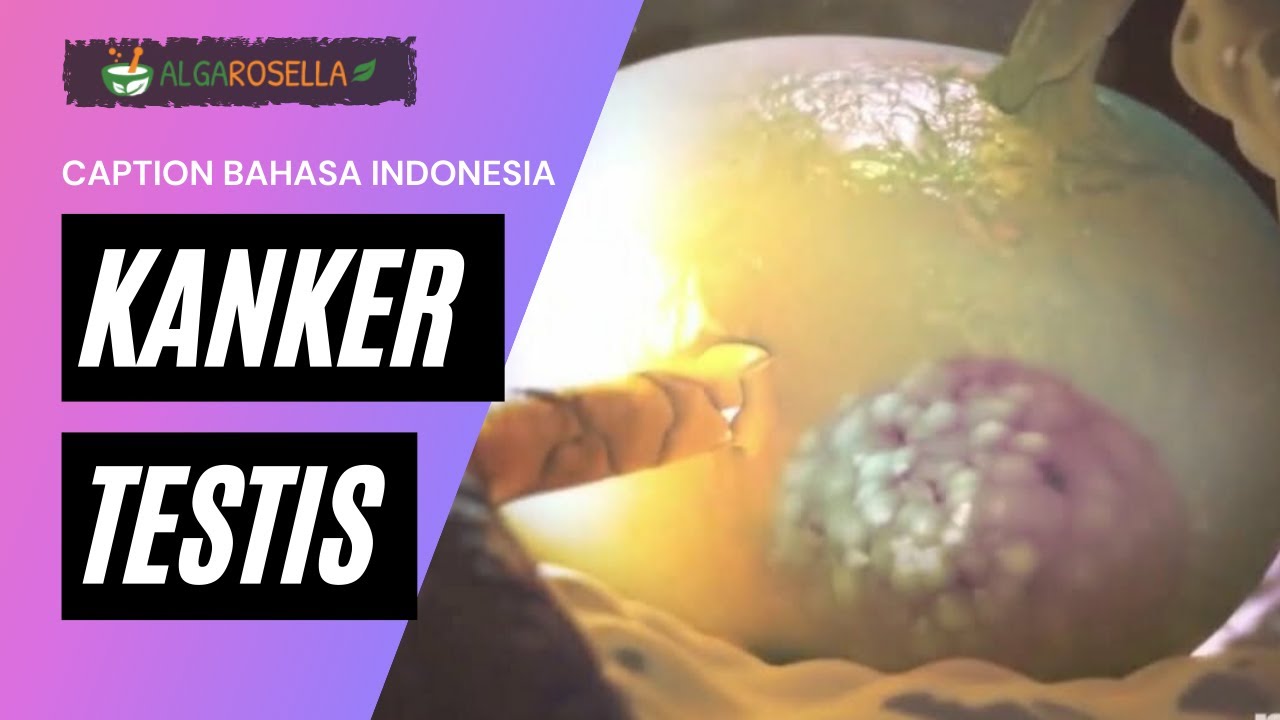 Video Animasi – Kanker Testis [sub Indonesia] - YouTube