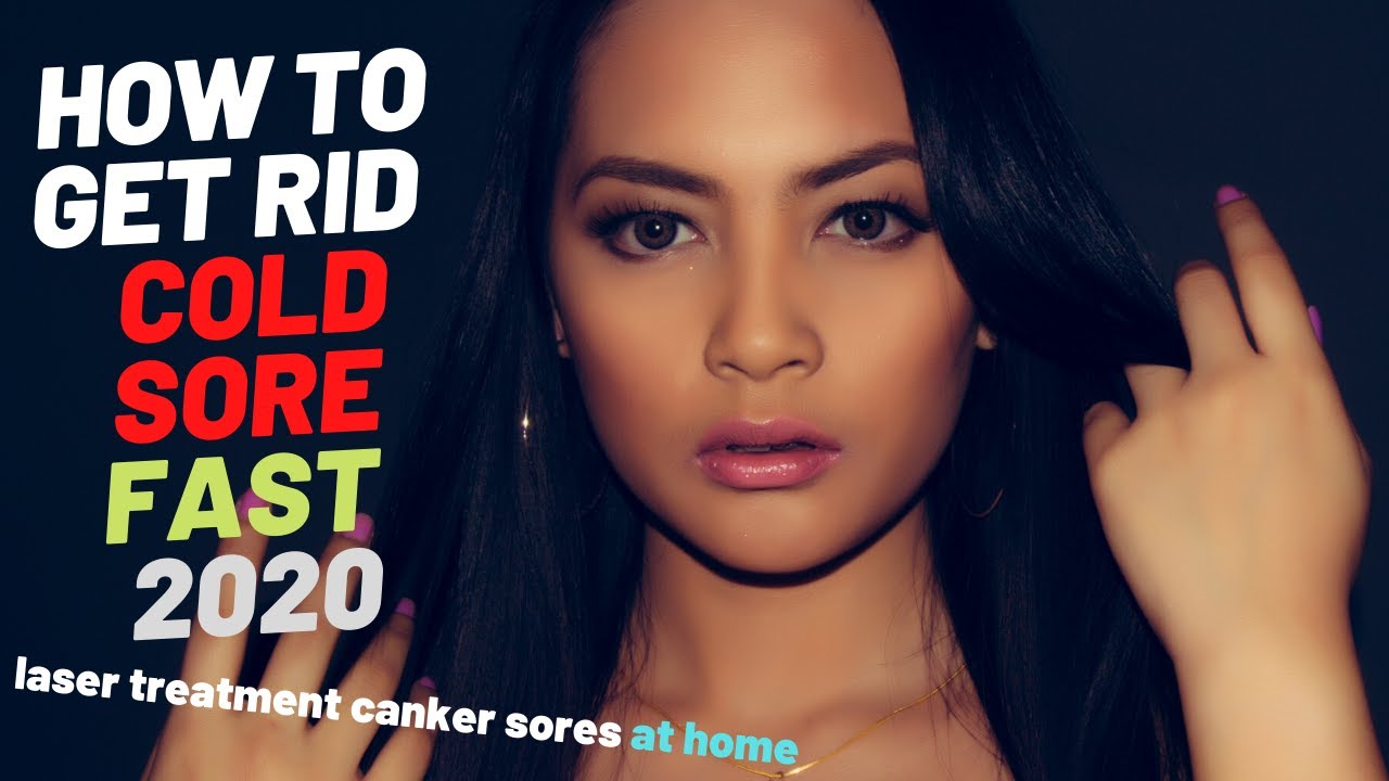 how to get rid cold sore fast 2020|Laser Treatment cold sore at home ...