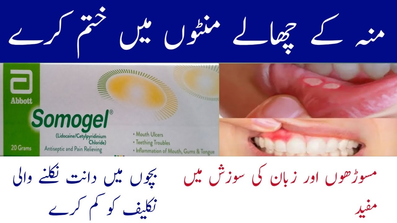somogel for mouth ulcers | somogel | sumo gel | somogel lagane ka ...