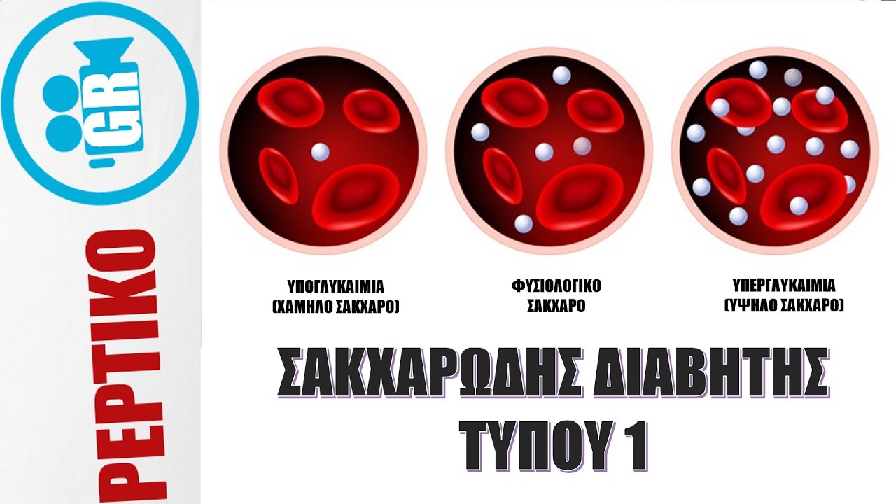 ΔΙΑΒΗΤΗΣ ΤΥΠΟΥ 1: Συμπτώματα, διάγνωση, θεραπεία! - peptiko.gr - YouTube