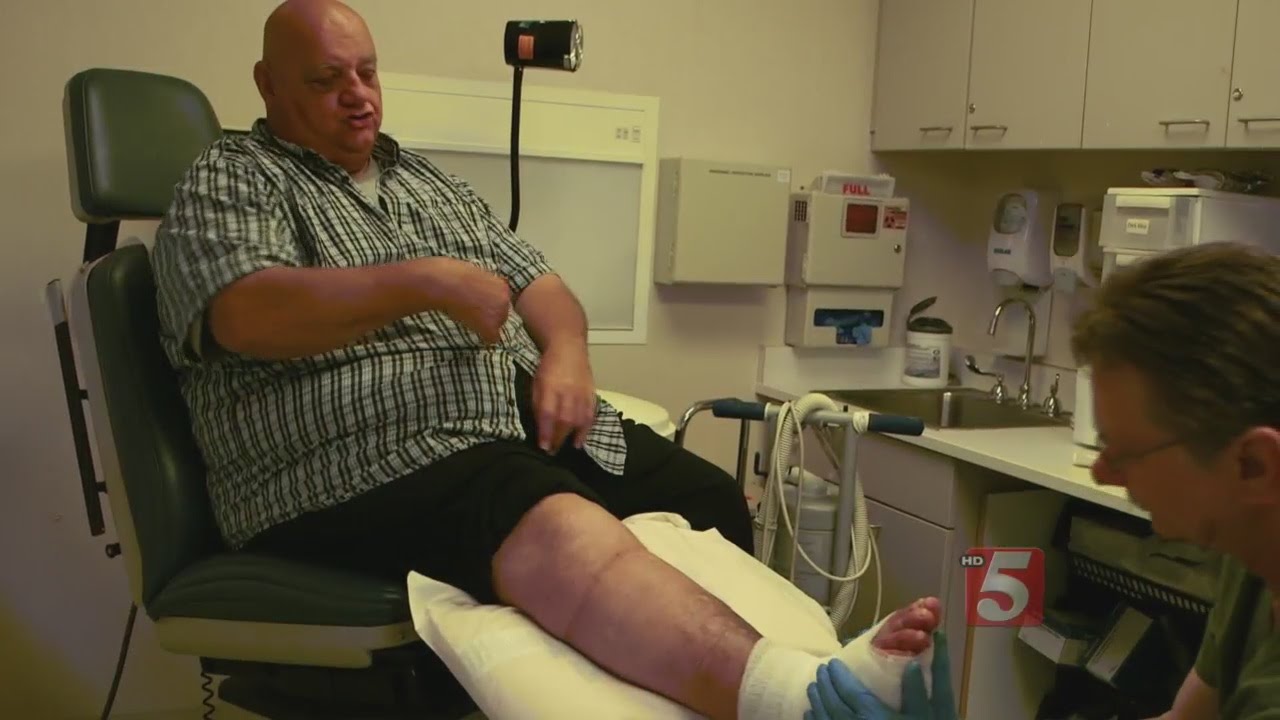 Charcot Foot: A Step Toward Avoiding Amputation - YouTube