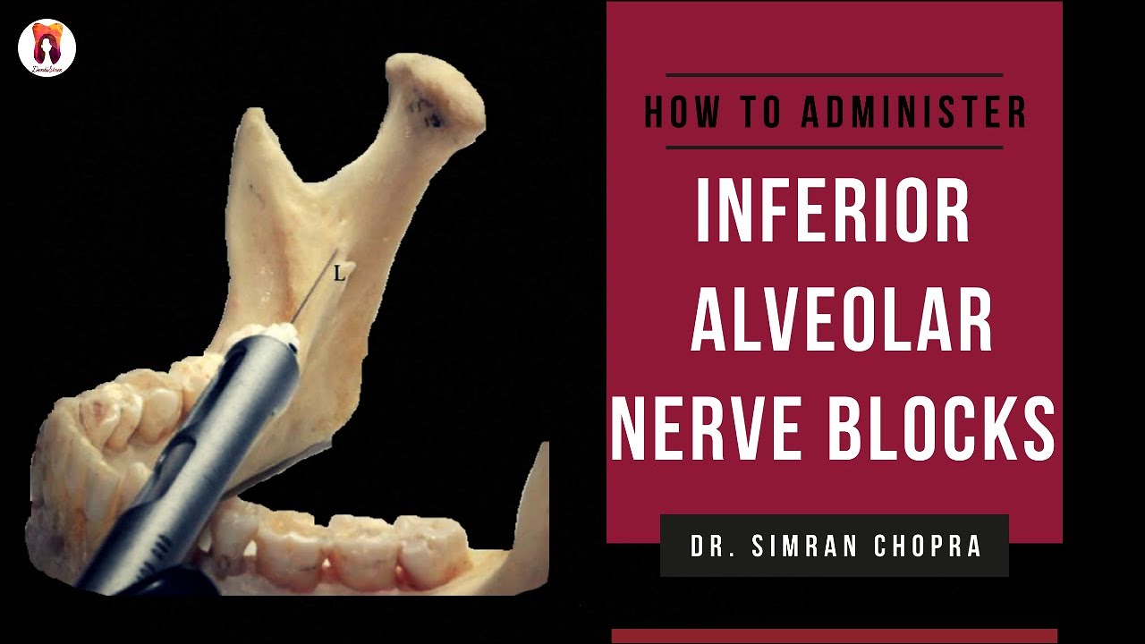 Inferior Alveolar Nerve Block Technique Video