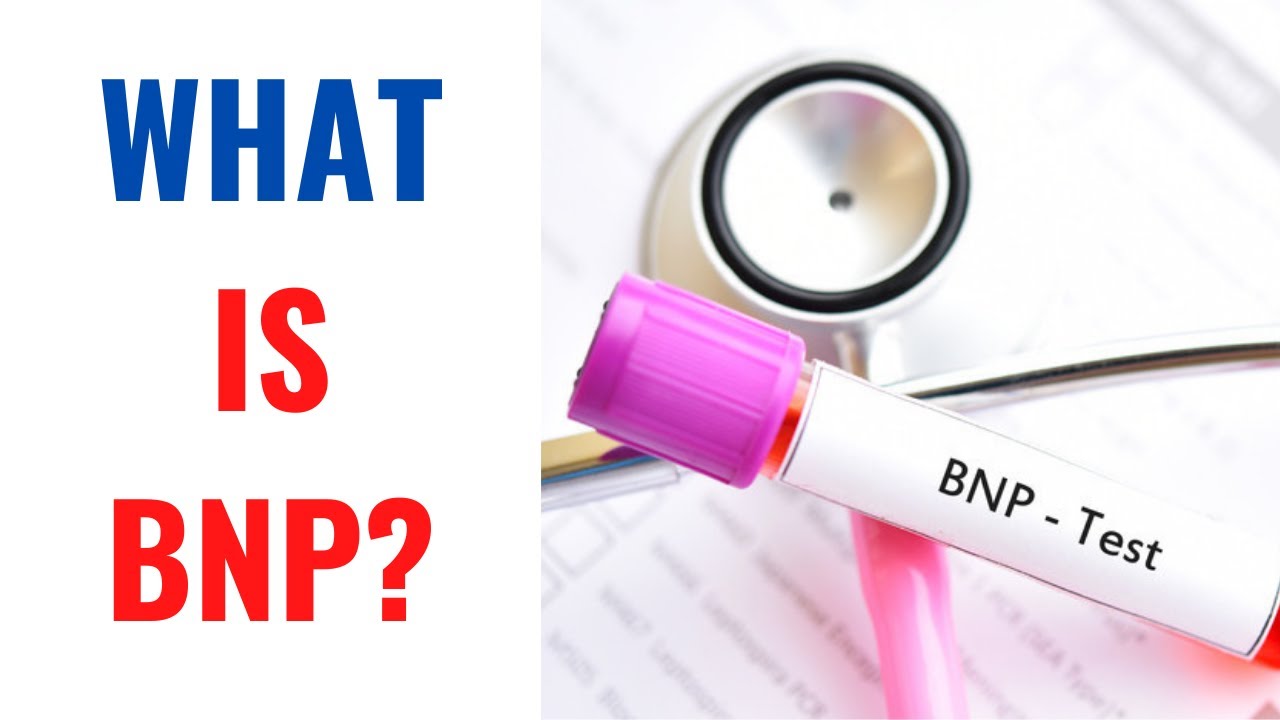 What is BNP Blood Test? Uses of BNP - YouTube