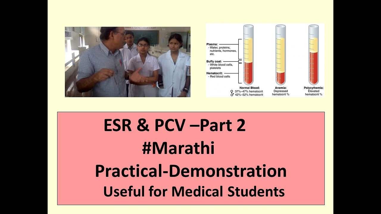 ESR Test l PCV test l Haematocrit l Packed Cell Volume l Part 2 l # ...