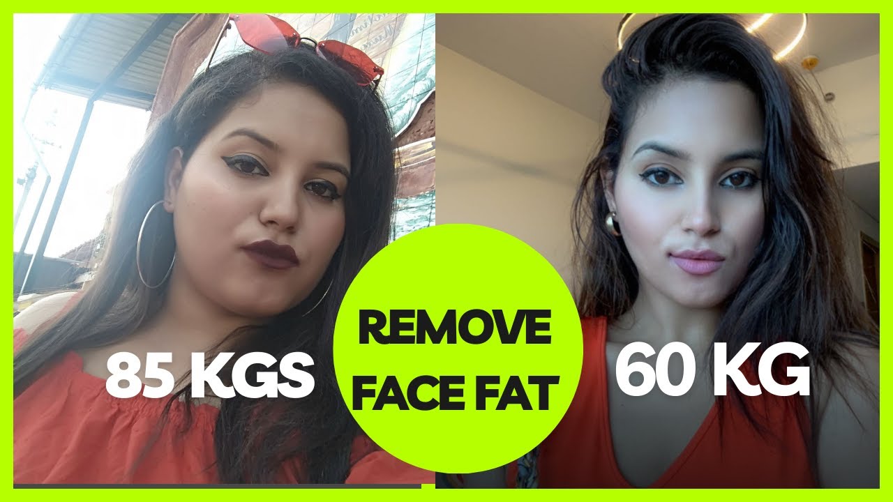 😱 Shocking Before and After: How I removed my Face Fat| Face Fat ...