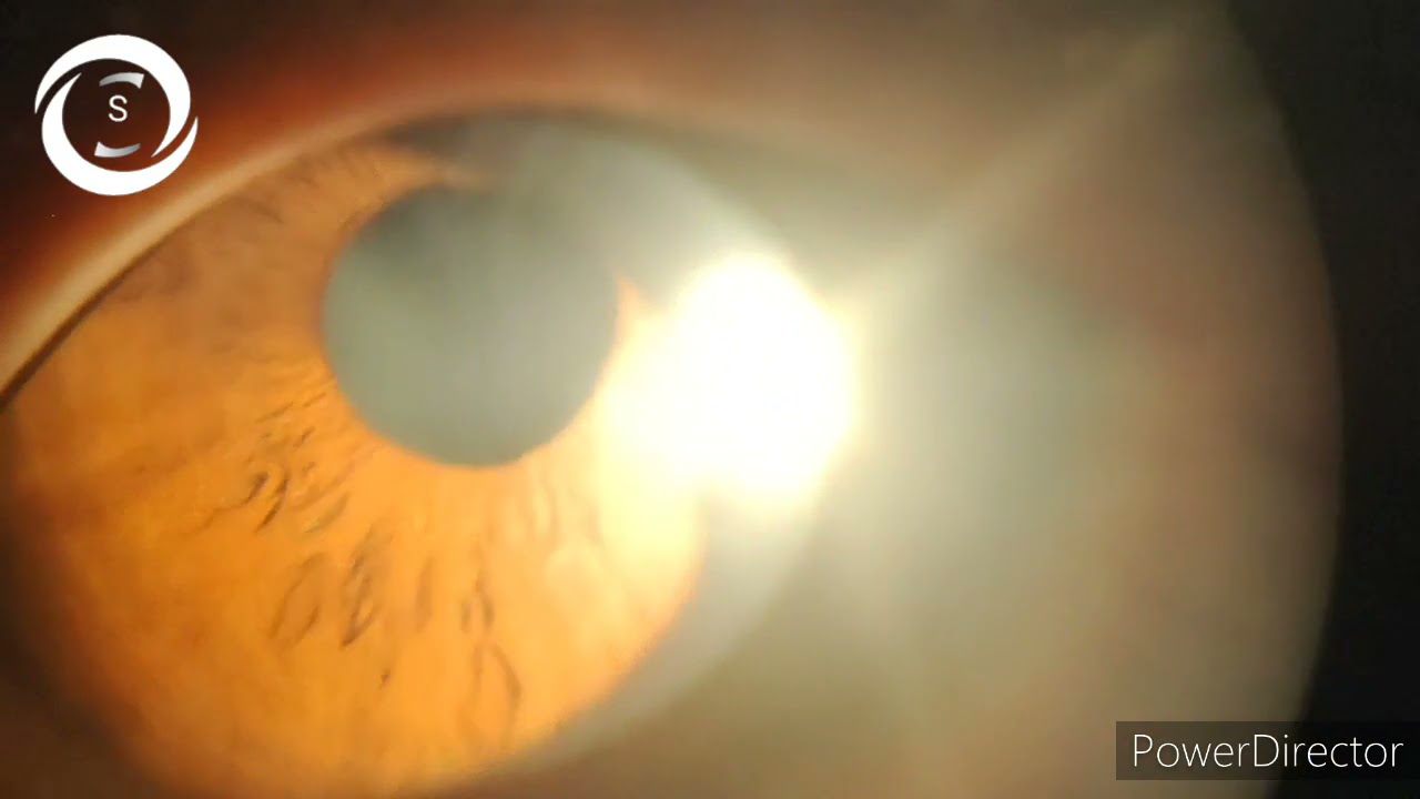 Haabs striae - YouTube