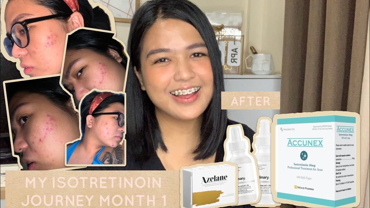 MY ACCUNEX JOURNEY (MONTH 1) ENGLISH - YouTube