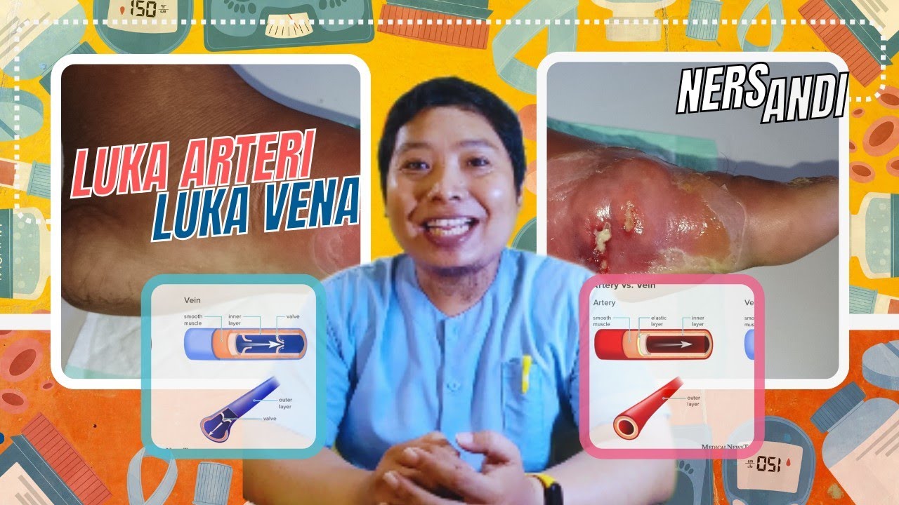 Ini Bedanya Luka Arteri dan Luka Vena #lukavena #lukaarteri # ...