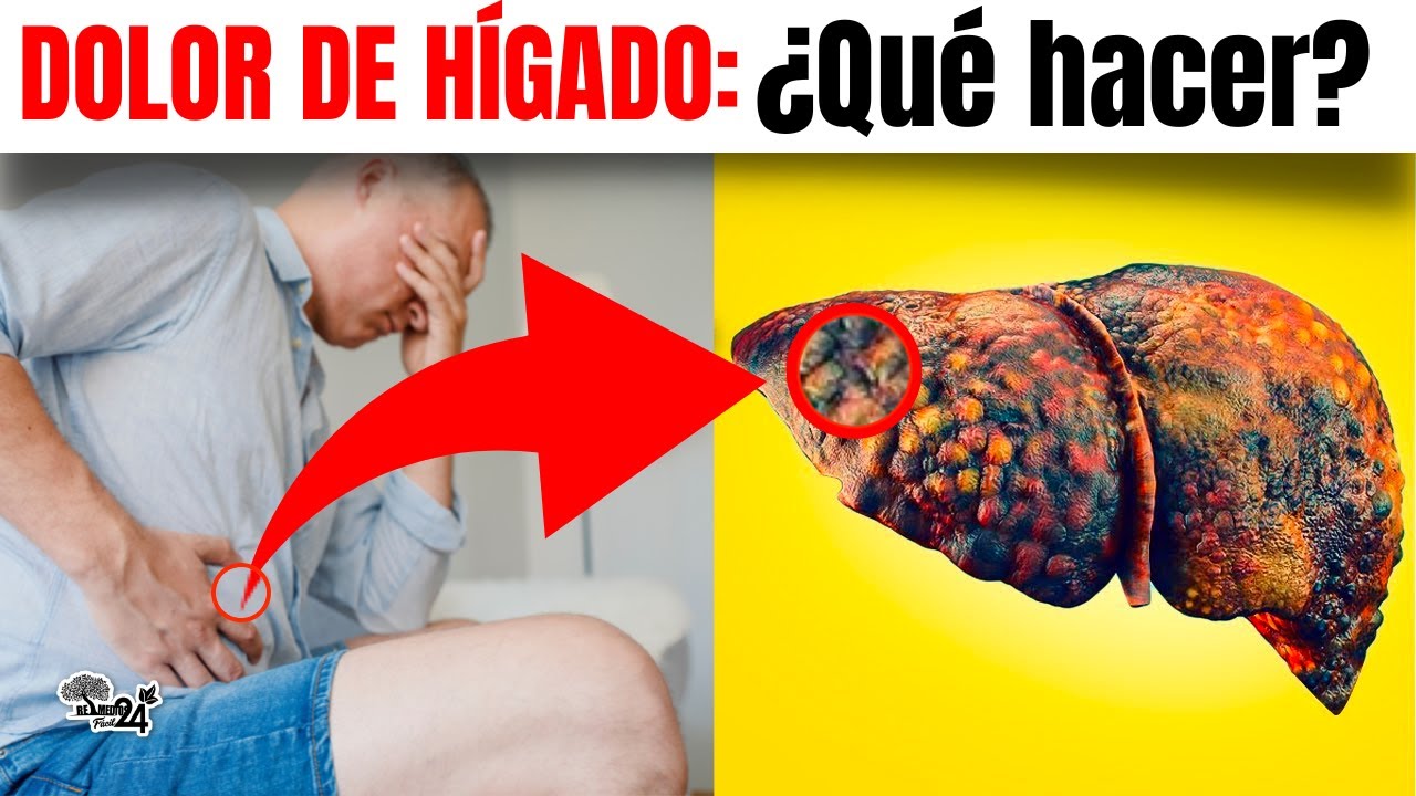 DOLOR DE HÍGADO: TODO LO QUE NECESITAS SABER CAUSAS Y TRATAMIENTOS ...