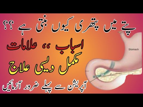 Pitta ki pathri ka ilaj | pitta ki pathri ka ilaj in urdu Gall bladder ...