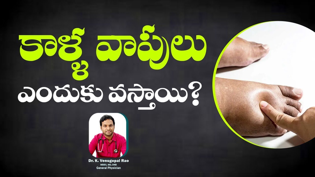 Reasons For Legs Swelling Dr Venu Gopal reasons-for-legs-swelling-dr-venu-gopal