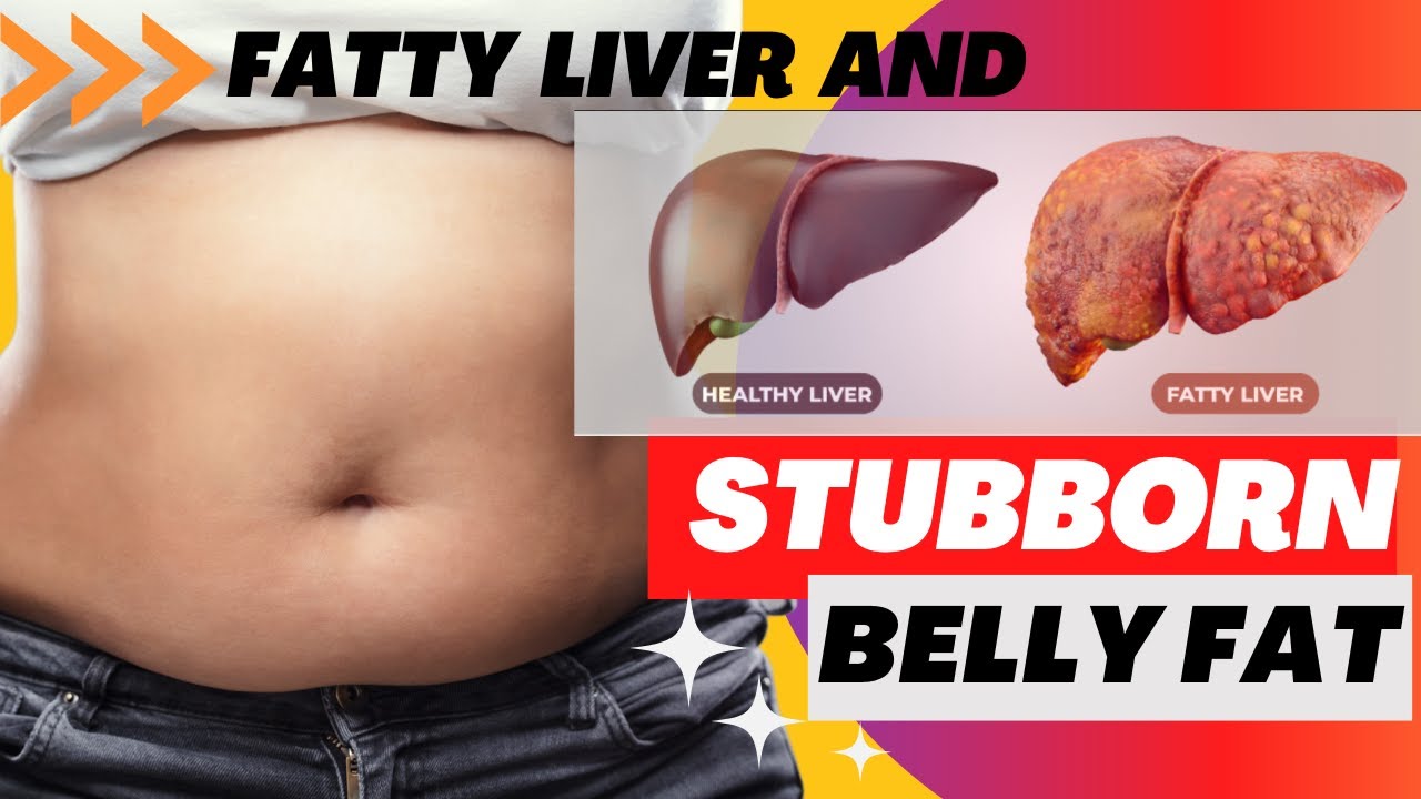 Fatty Liver Disease And The Stubborn Belly Fat Problem - YouTube
