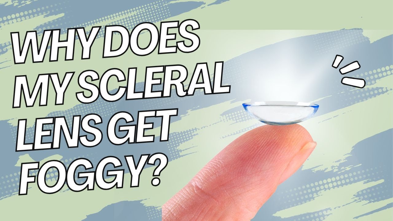 What does my scleral lens get foggy? - YouTube