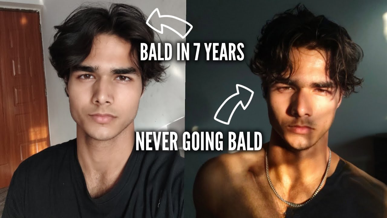 This Will Fix Your Hairfall ⁉️ (Watch Before it is too late ...