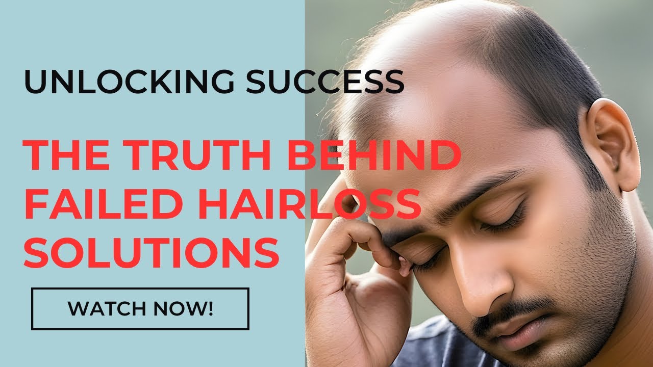 Failed HairLoss Solutions EXPOSED! Discover Scalp Micropigmentation ...