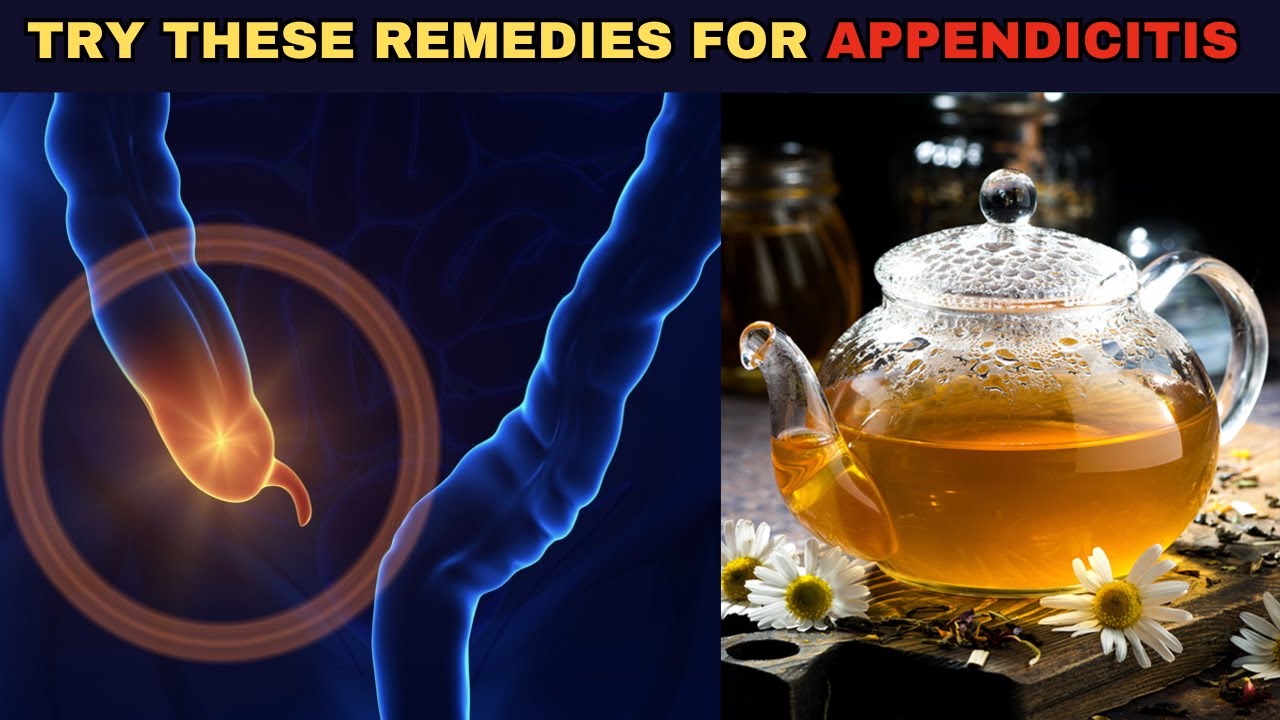 Try These Home Remedies For Appendicitis | Appendicitis Management ...