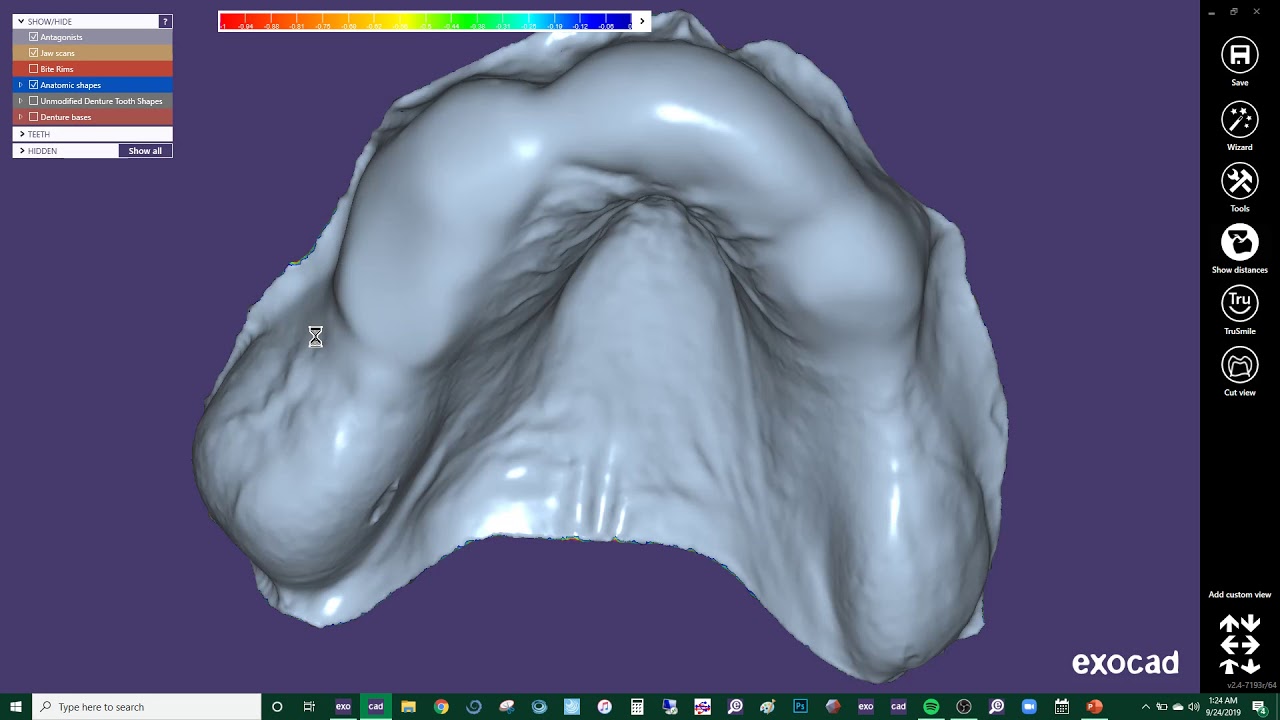 exocad full denture model single arch setup - YouTube