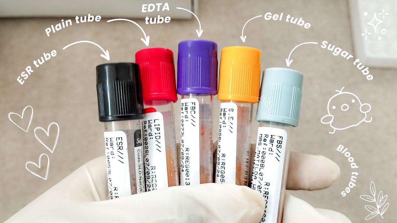 Types of blood collection tubes 🌸🔬 Colour coded | Blood bottles guide ...