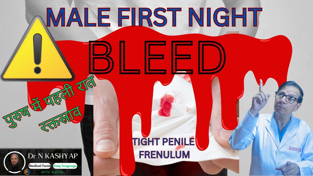 VERGIN MALE FIRST NIGHT BLEED-A PAINFULL TRUTH-Tight FRENULUM-A MUST ...