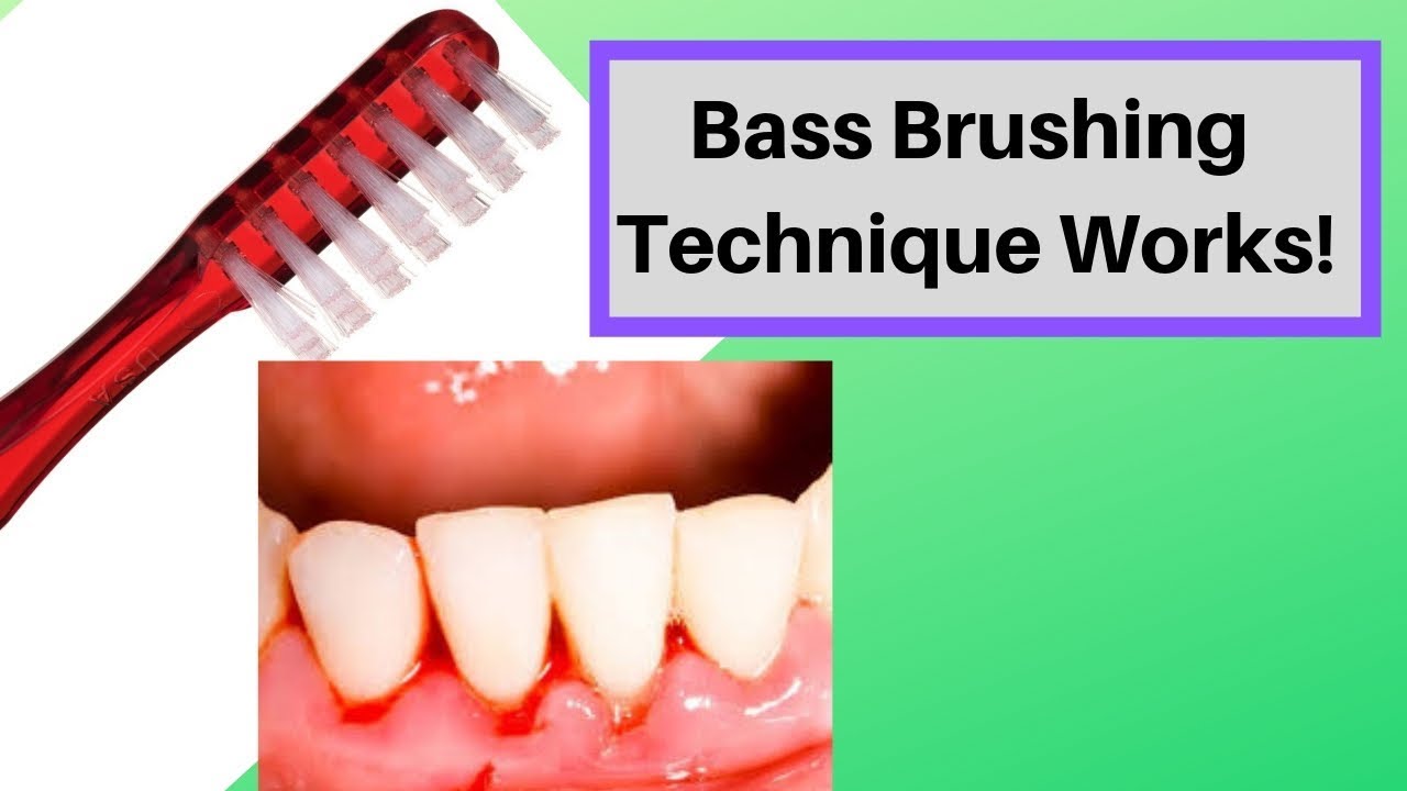 Use The Bass Brushing Technique To Dramatically Stop Gum Disease! - YouTube
