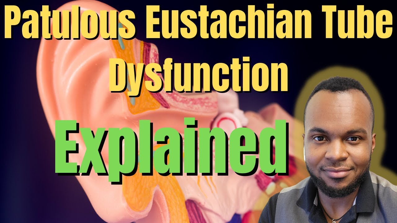 Patulous Eustachian Tube Explained- 3 Things To Be Aware Of - YouTube