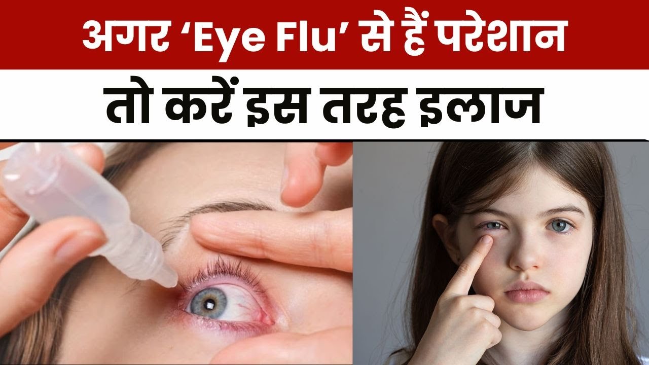 अगर ‘Eye Flu’ से हैं परेशान, तो करें इस तरह इलाज | EYE FLU | PREVENTION ...