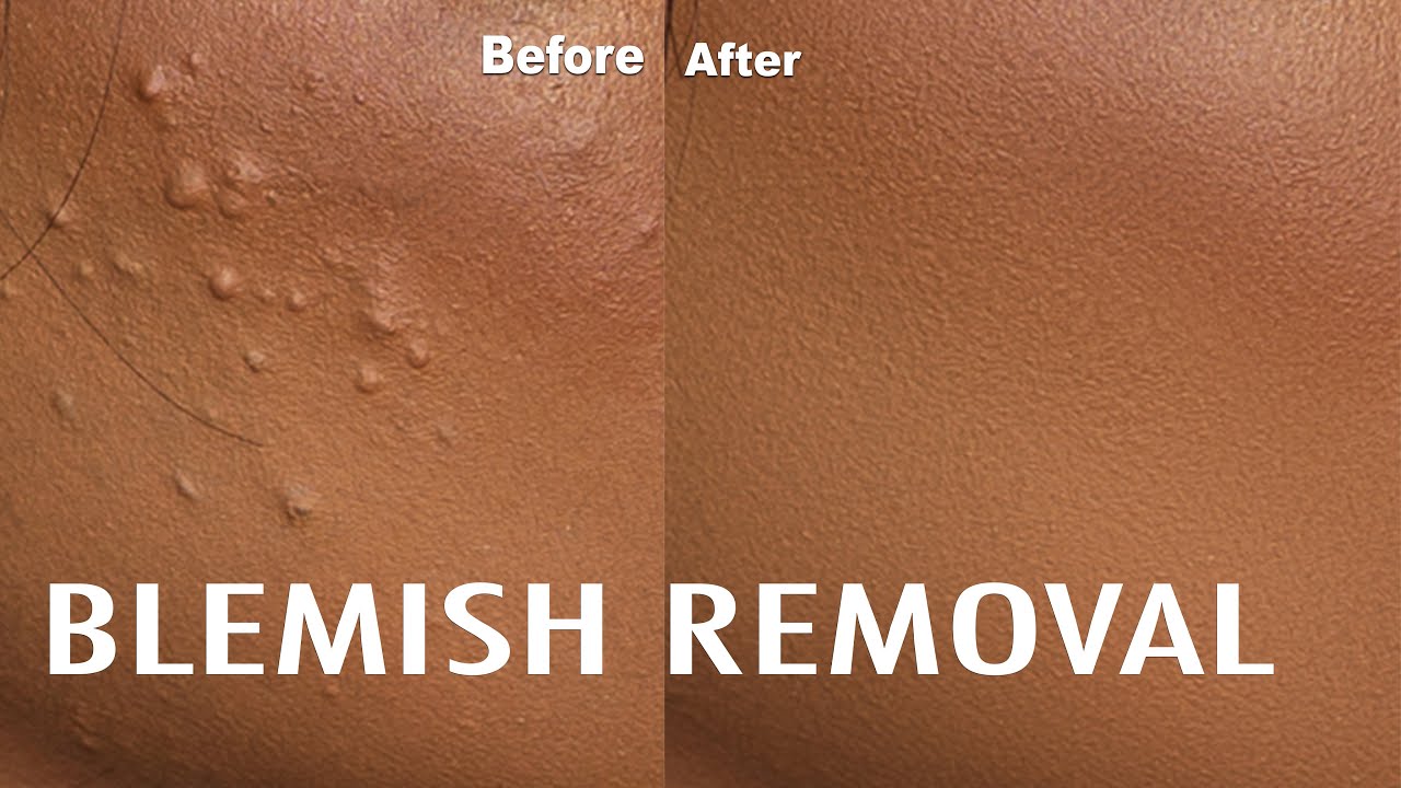 How To REMOVE BLEMISHES IN PHOTOSHOP | Complete Guide To Blemish ...
