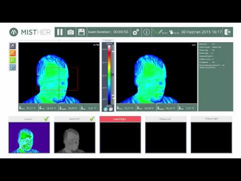 Misther Thermal Camera Application - Breast Mode Demo