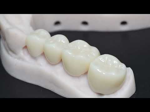 What Is Most Common Material Used For Tooth Crown