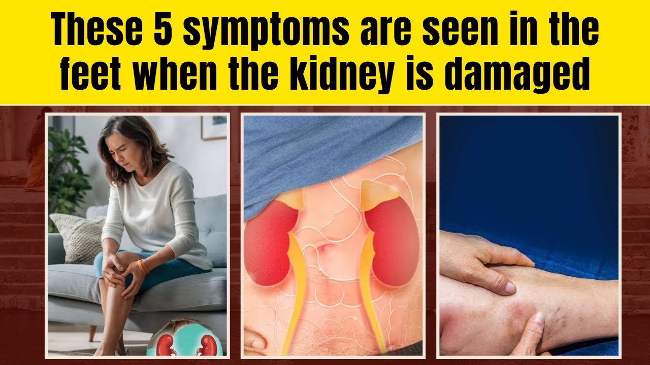 The Hidden Symptoms of Kidney Damage (in Your Feet) - YouTube