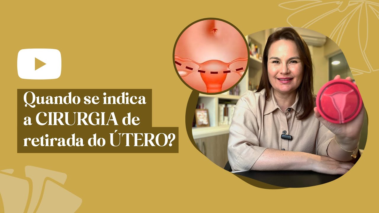 Quando se indica a CIRURGIA de retirada do ÚTERO? - YouTube