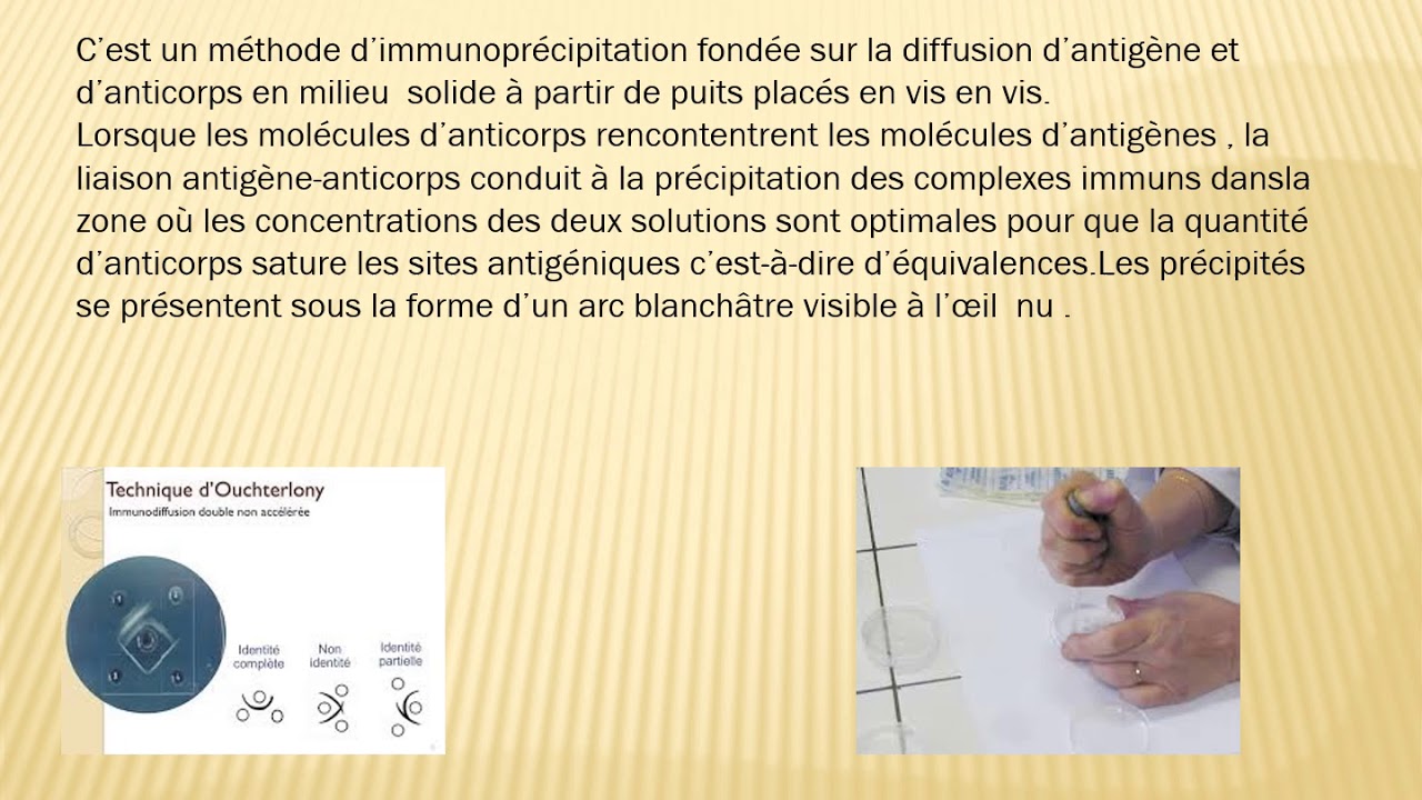 Tp immunodiffusion double selon la méthode d'ouchterlony clara delpouve ...