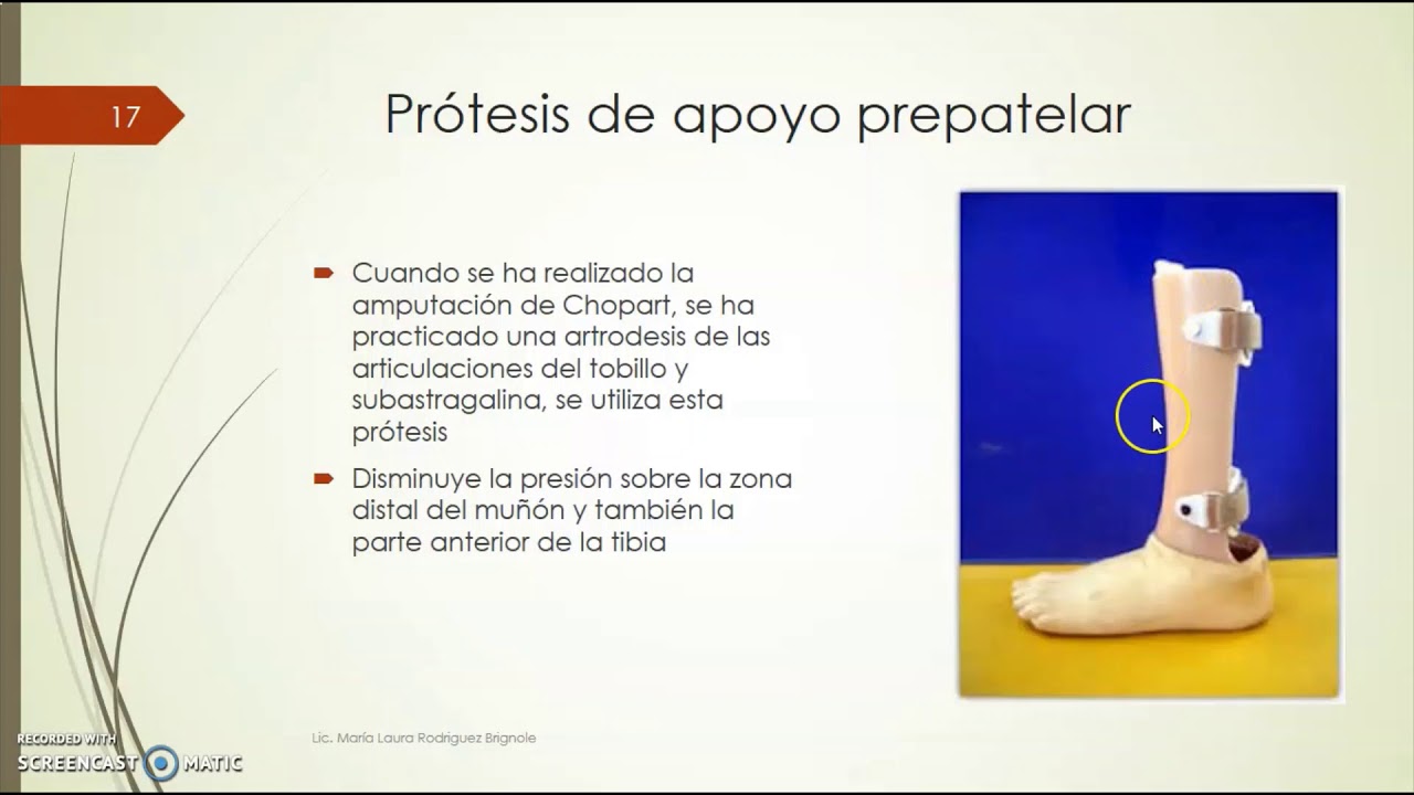 Prótesis de MMII 3° parte - YouTube