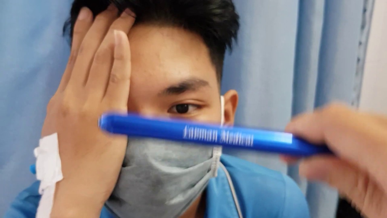 Bilateral Foville Syndrome (Hội chứng Foville 2 bên) hay là WEBINO ...