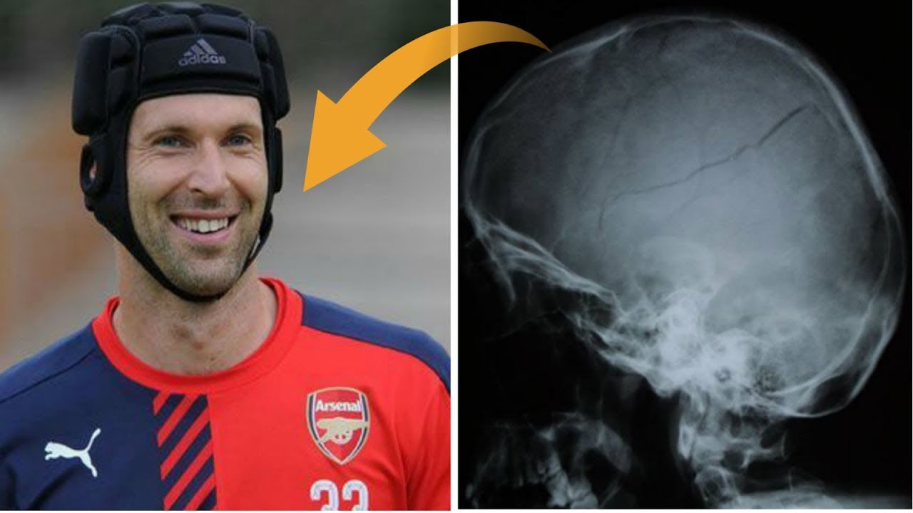 La Historia del Casco Petr Cech - YouTube