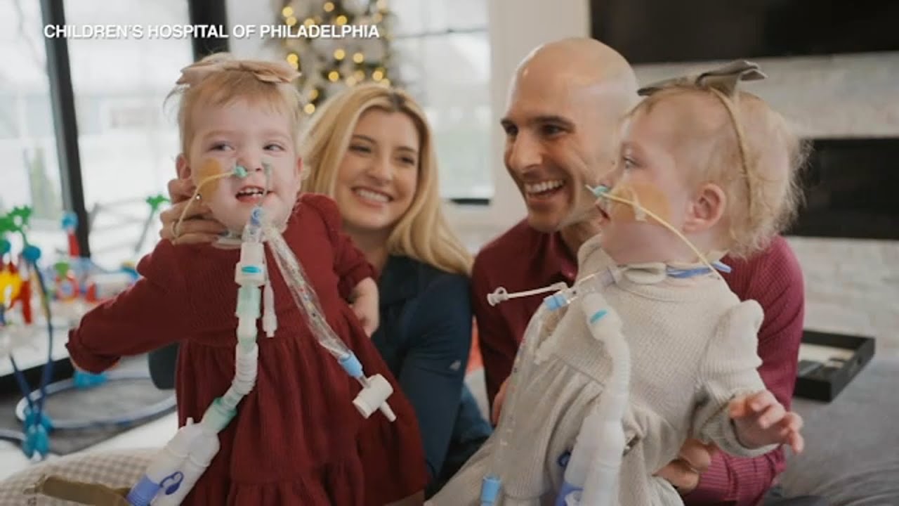 Conjoined Altobelli twins separated; family returns to Chicago after ...